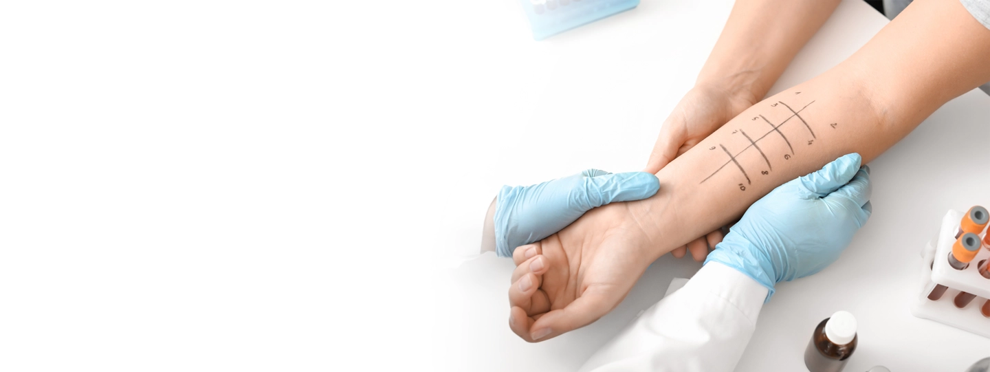Skin Prick Allergy Test in Mumbai, India | Procedure, Benefits & Cost ...